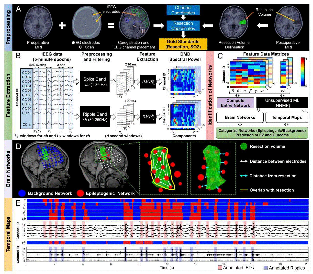 Published Study: New AI Tool Detects Origins of Seizures