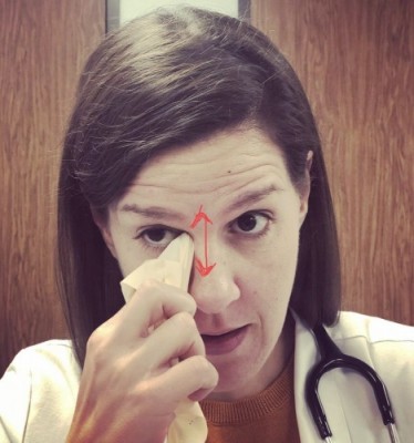 Let's Talk About ... Teary, Gooey Baby Eyes