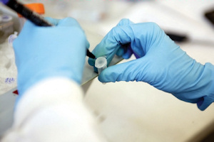 Rare genetic variations of DNA implicated in autism