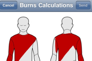 Burns app could save lives at the touch of a button