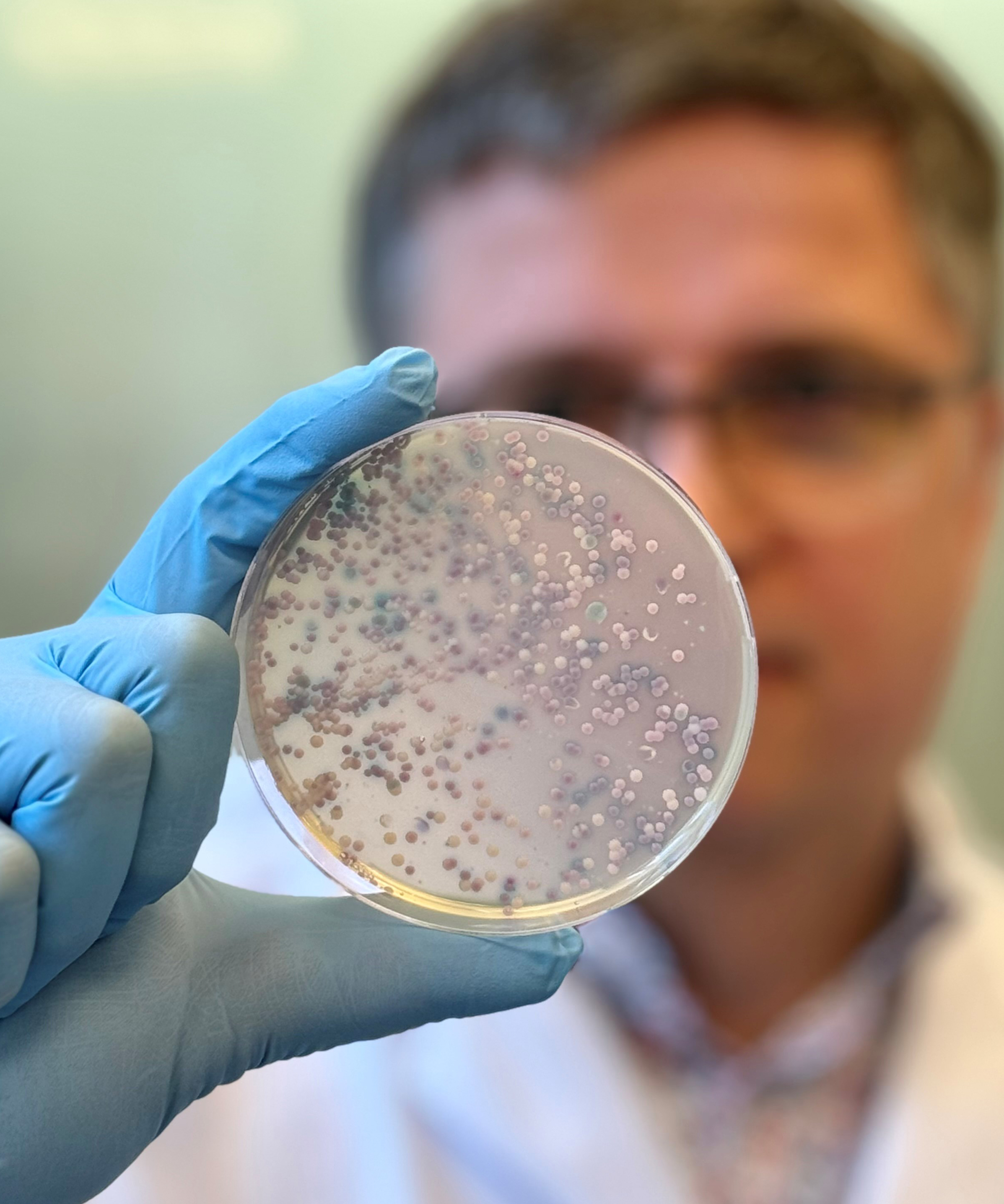 Guidelines on management of fungal infections caused by Candida published
