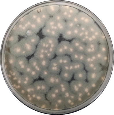 Deadly Mould Strains Likely to Resist New Drugs | Mirage News