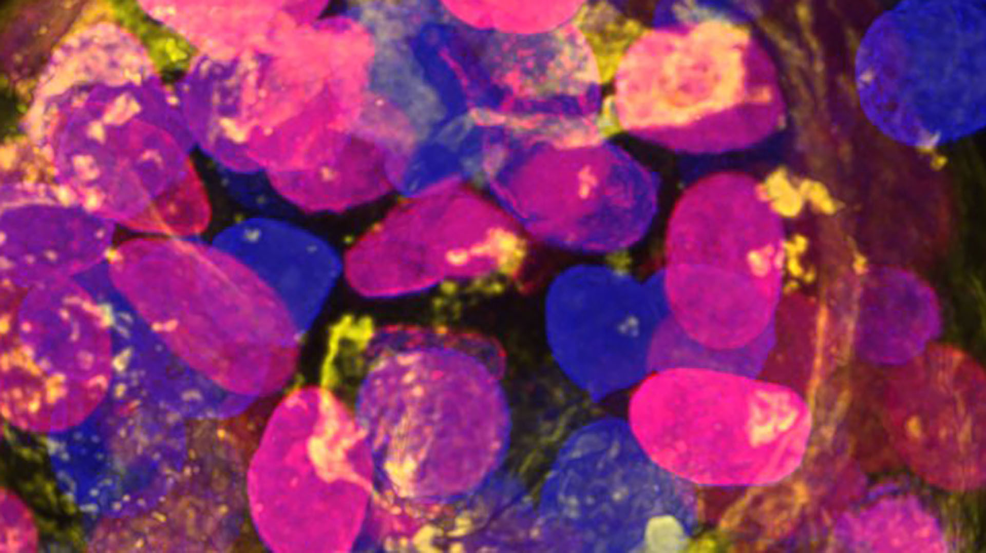 Curing cancer: finding new ways to identify and treat cancer cells