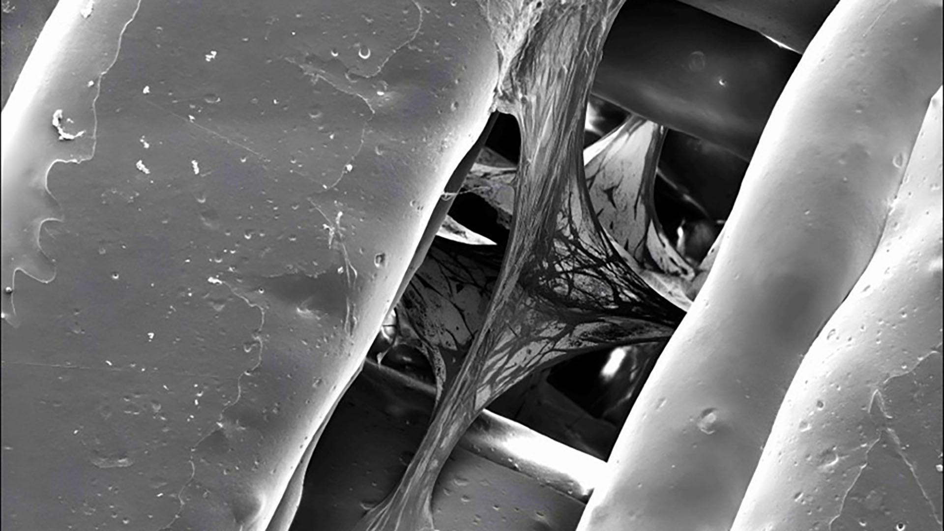 Building bones: 3D printing the future of bone tissue engineering