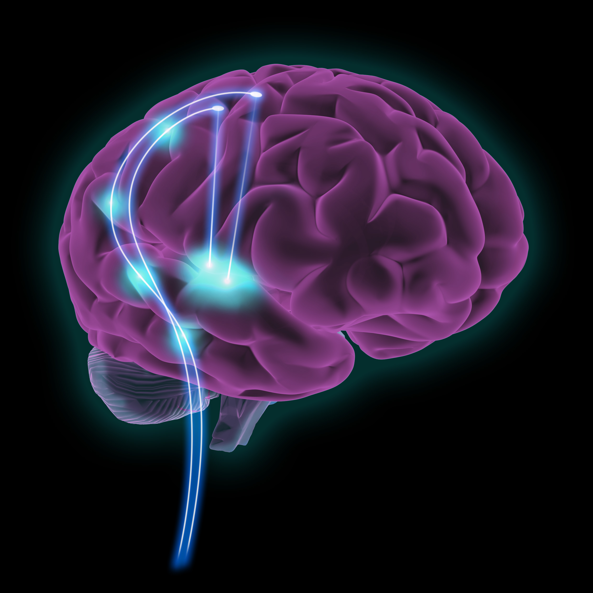 New graphene-based neural probes improve detection of epileptic brain ...