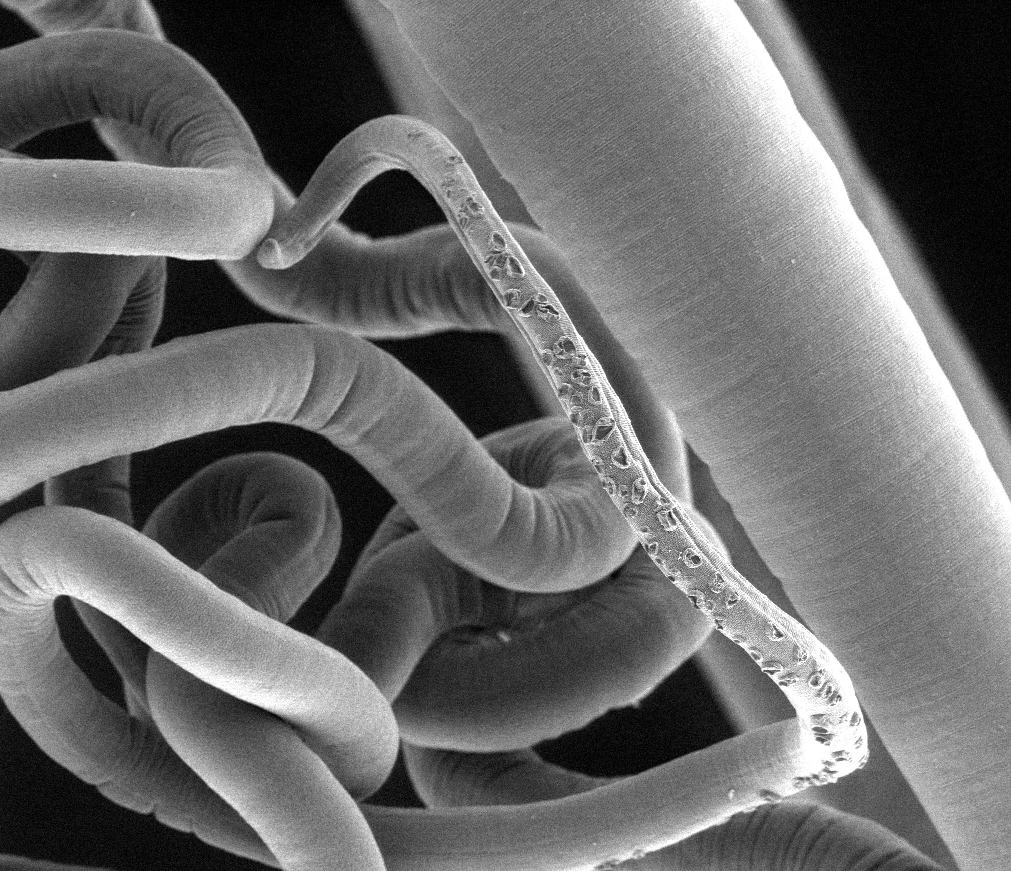 Parasitic worms have own gut microflora