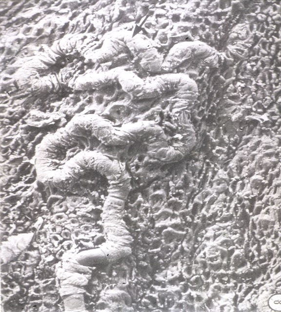 Parasitic worms have own gut microflora