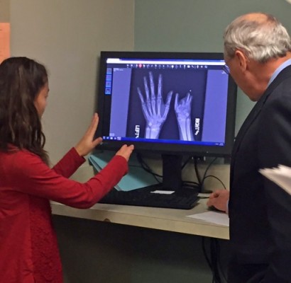 Finger lengthening procedure enables young girl to play the violin and ...