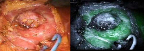 Firefly Lighting Up Operating Rooms | OhioHealth Newsroom