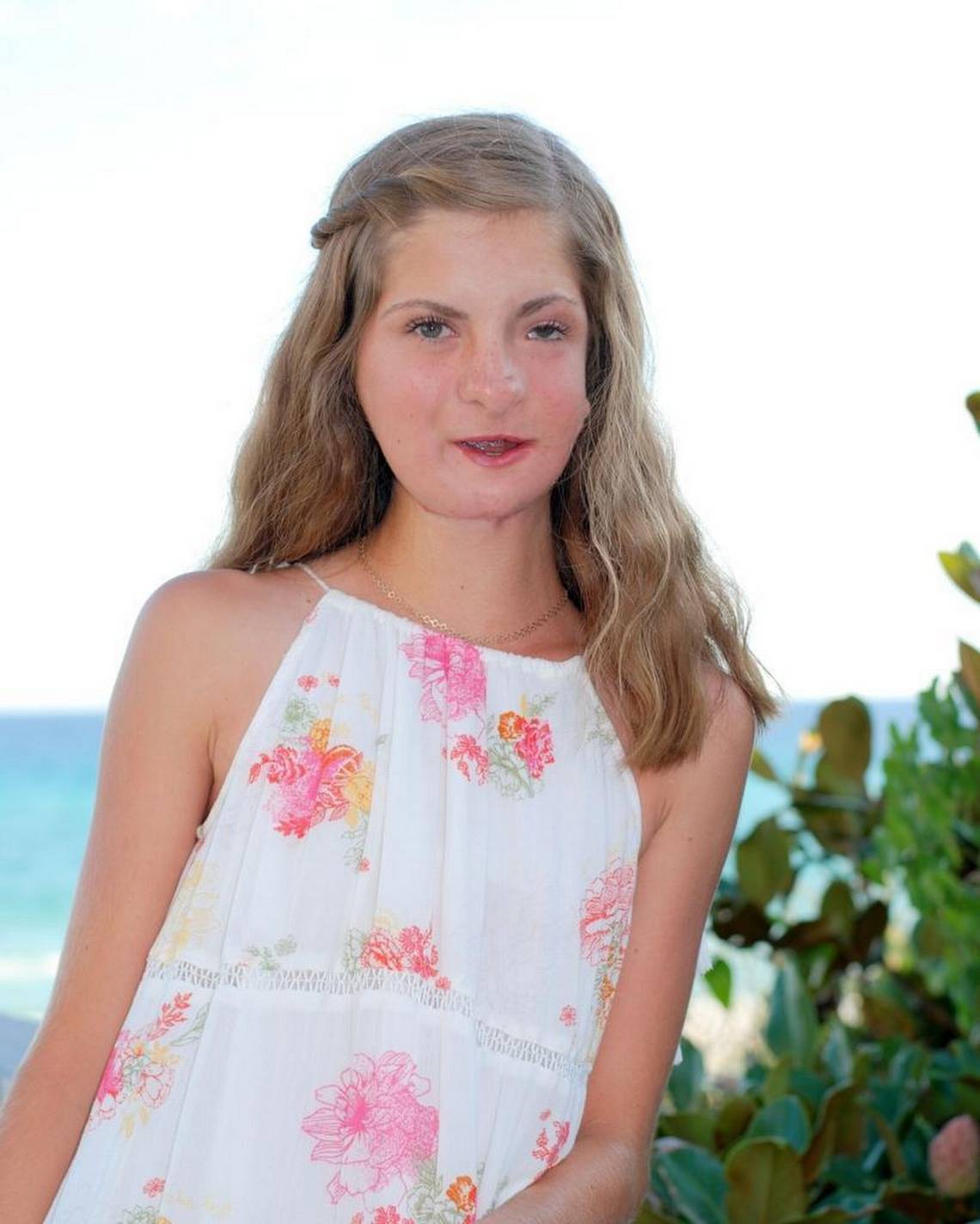 Kansas City Star: "Wonder" Movie Gives These Kansas Girls Hope