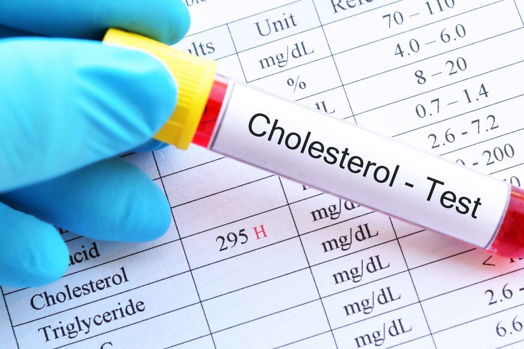 The Good and Bad About Cholesterol