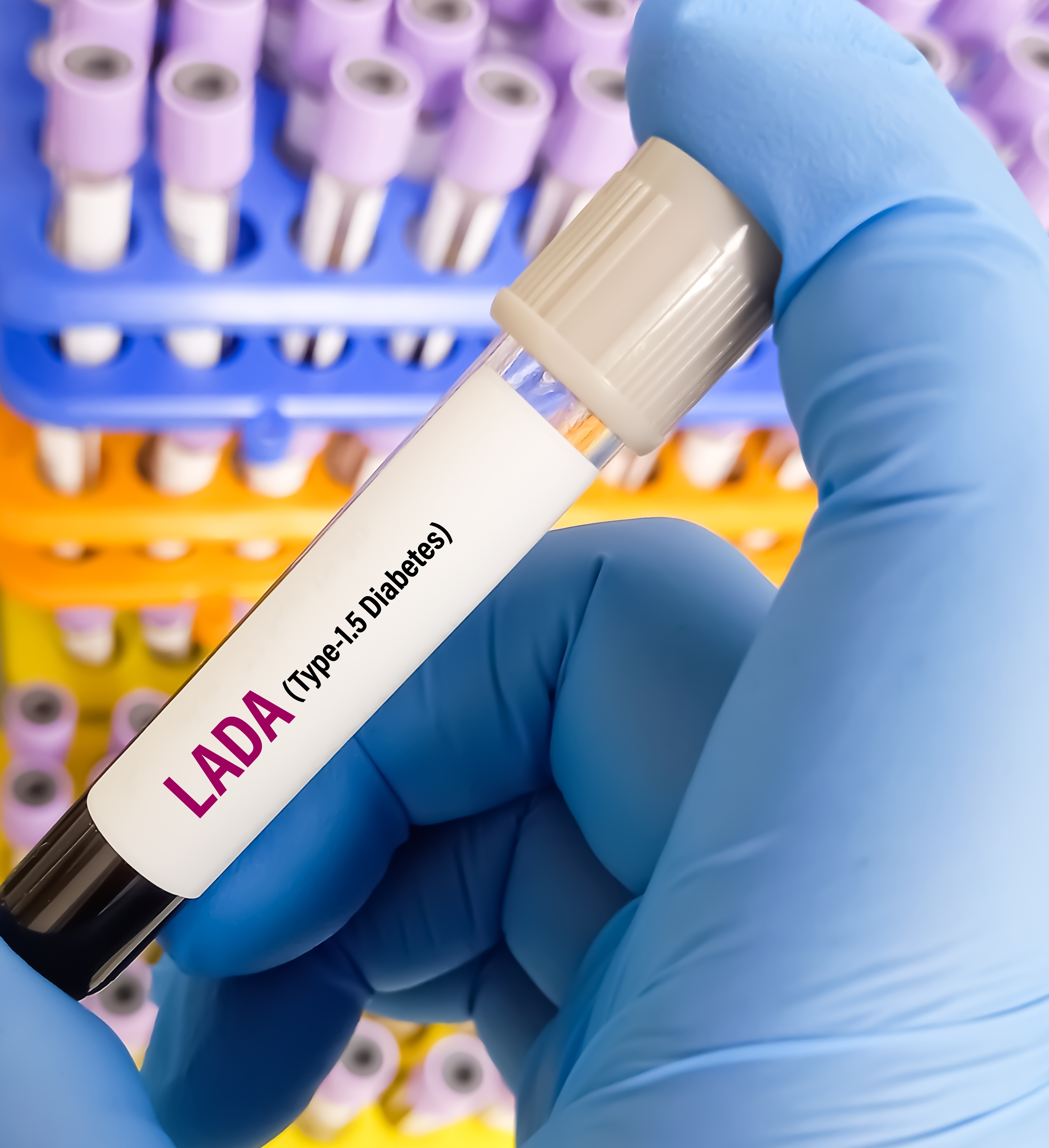 1, 1.5 and 2: The numbers of diabetes