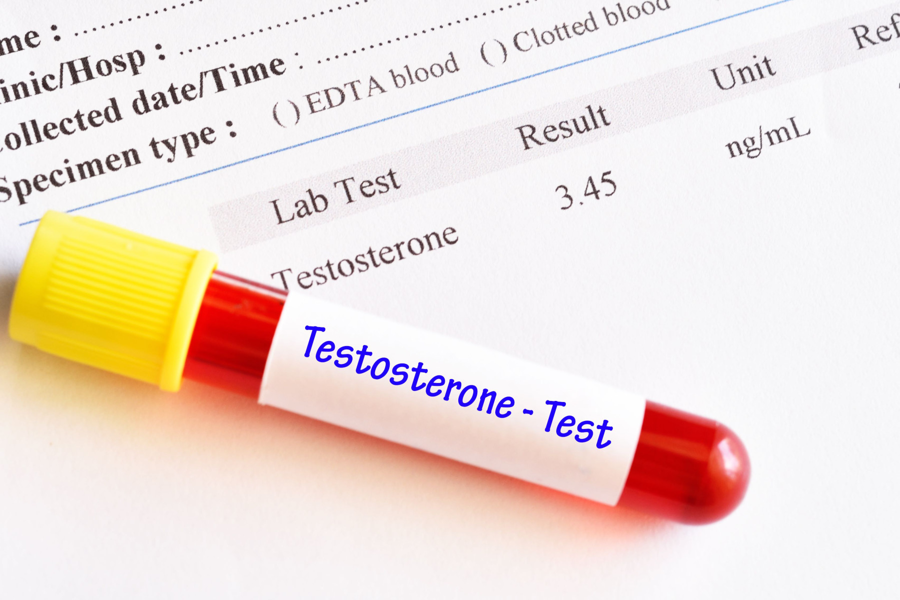 Study shows low testosterone can increase mortality risk