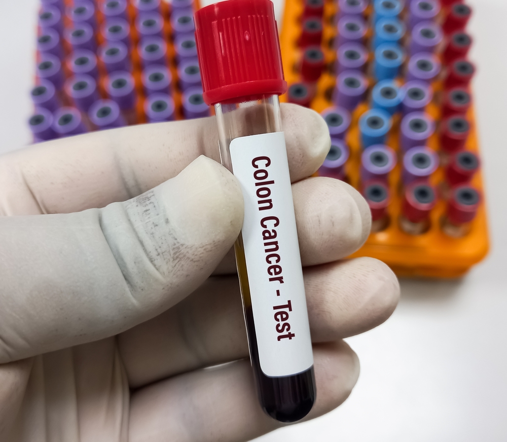 New FDA-approved blood test could boost screening for deadly colorectal ...