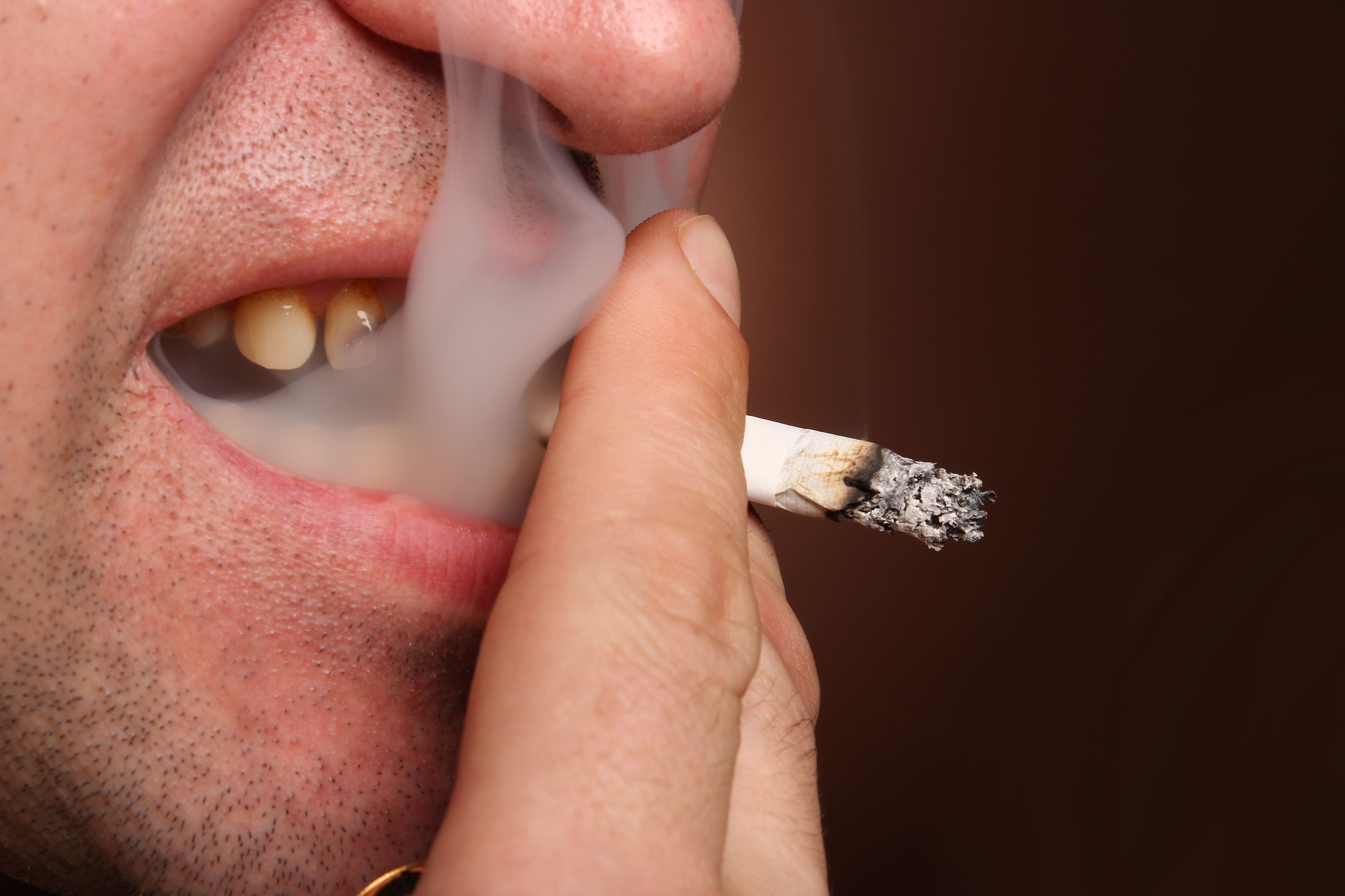 No lip service when it comes to oral cancer