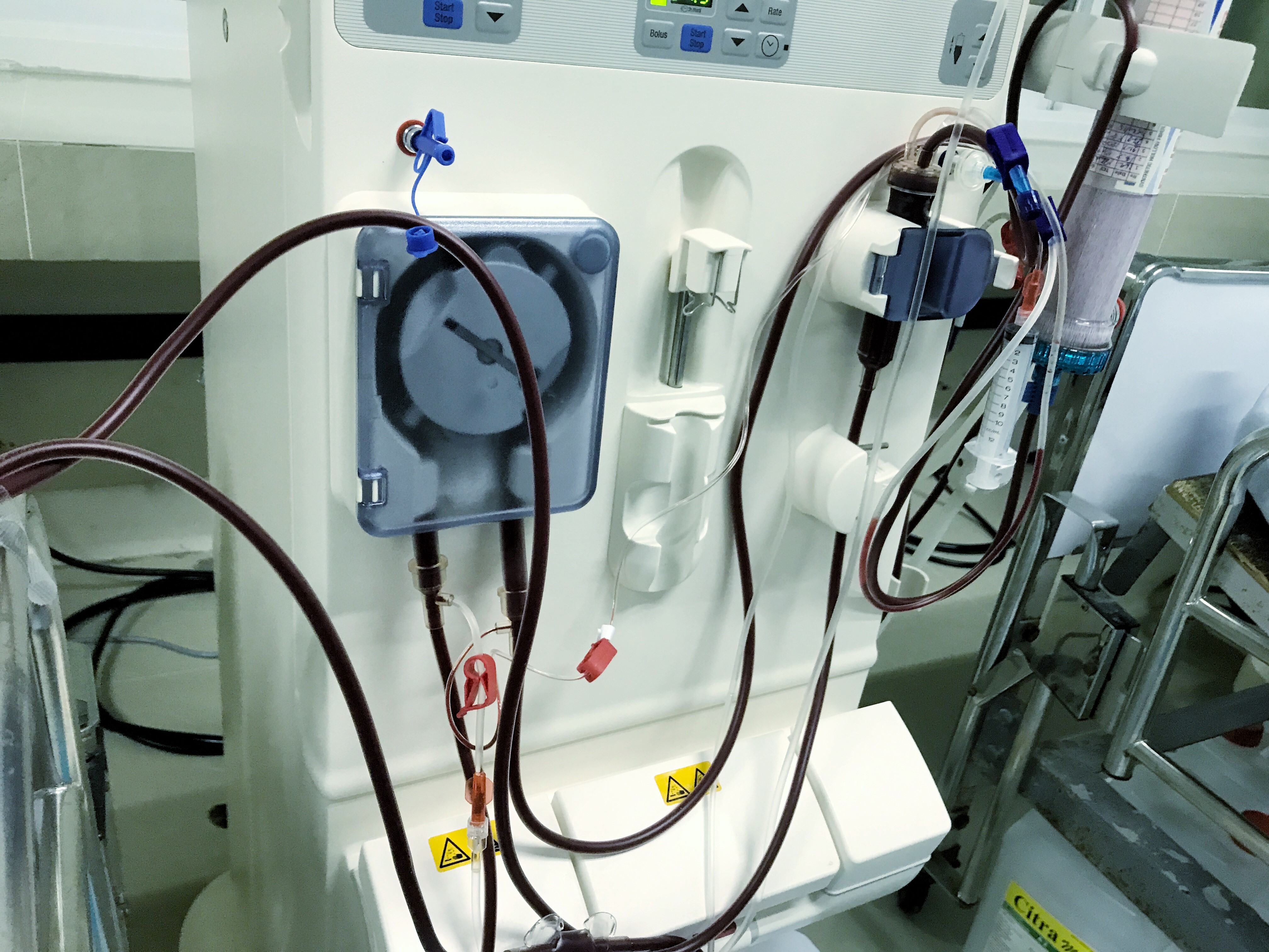 A New Approach to Kidney Care