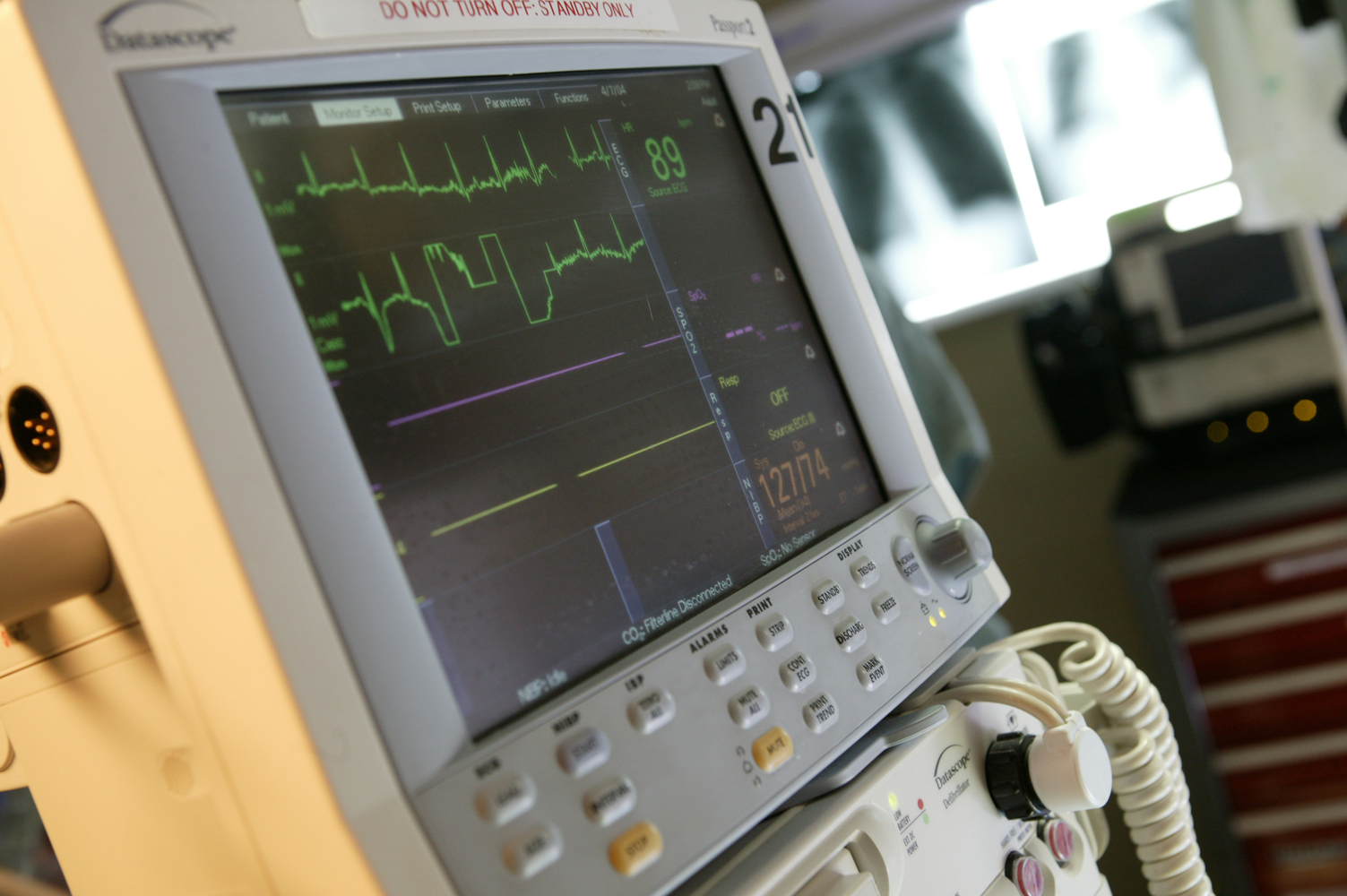 Know the Signs of a Heart Attack