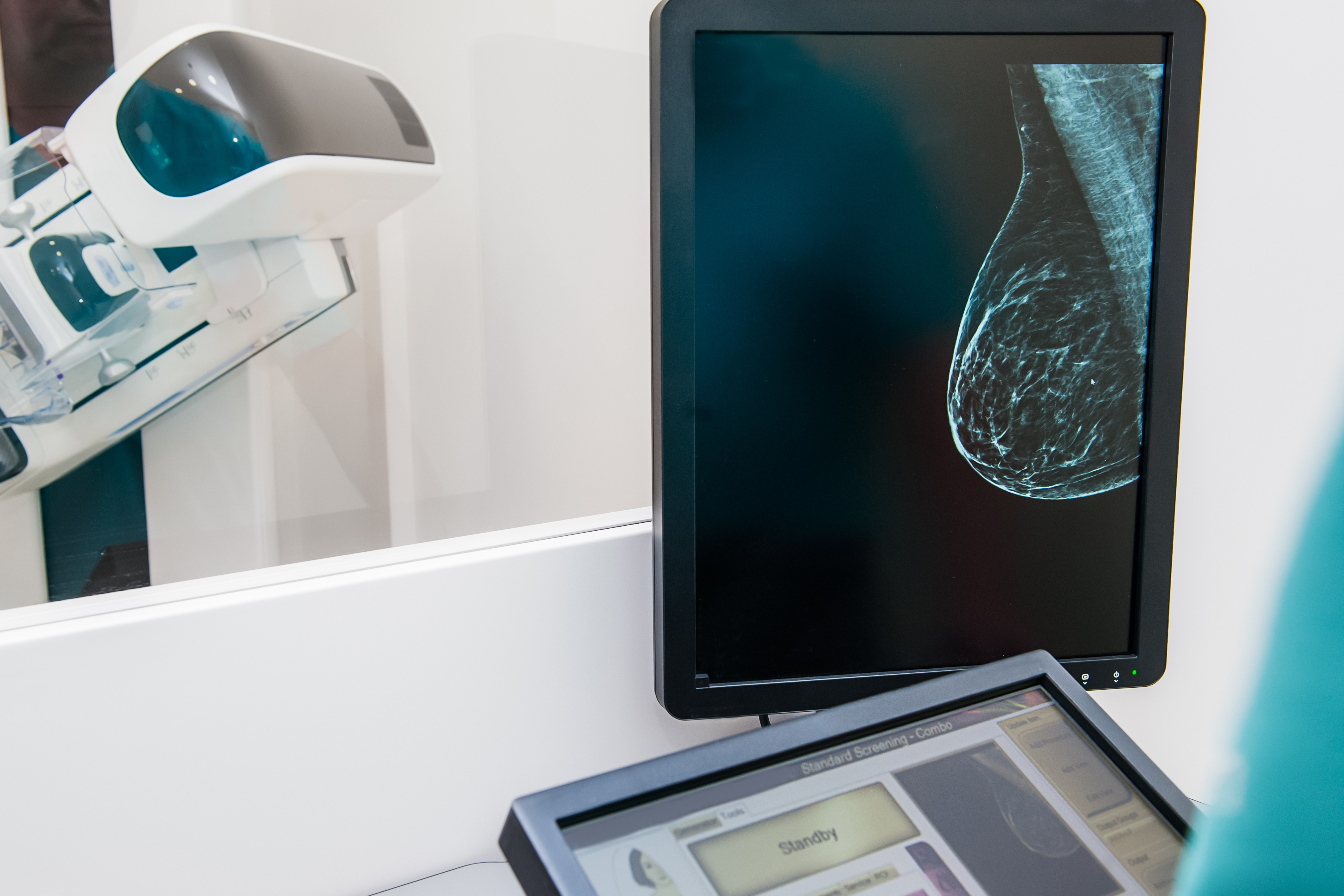 What OB/GYNs Want You to Know About Mammograms