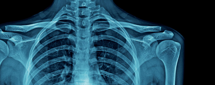 Through the Decades … Del Mar College Radiologic Technology Alums ...