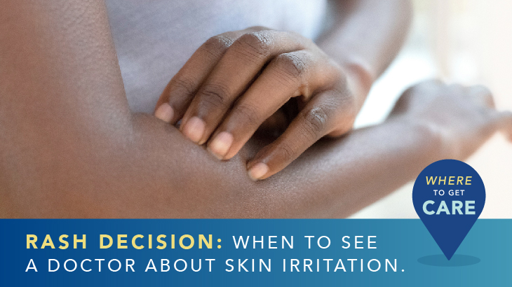 Treating a skin rash
