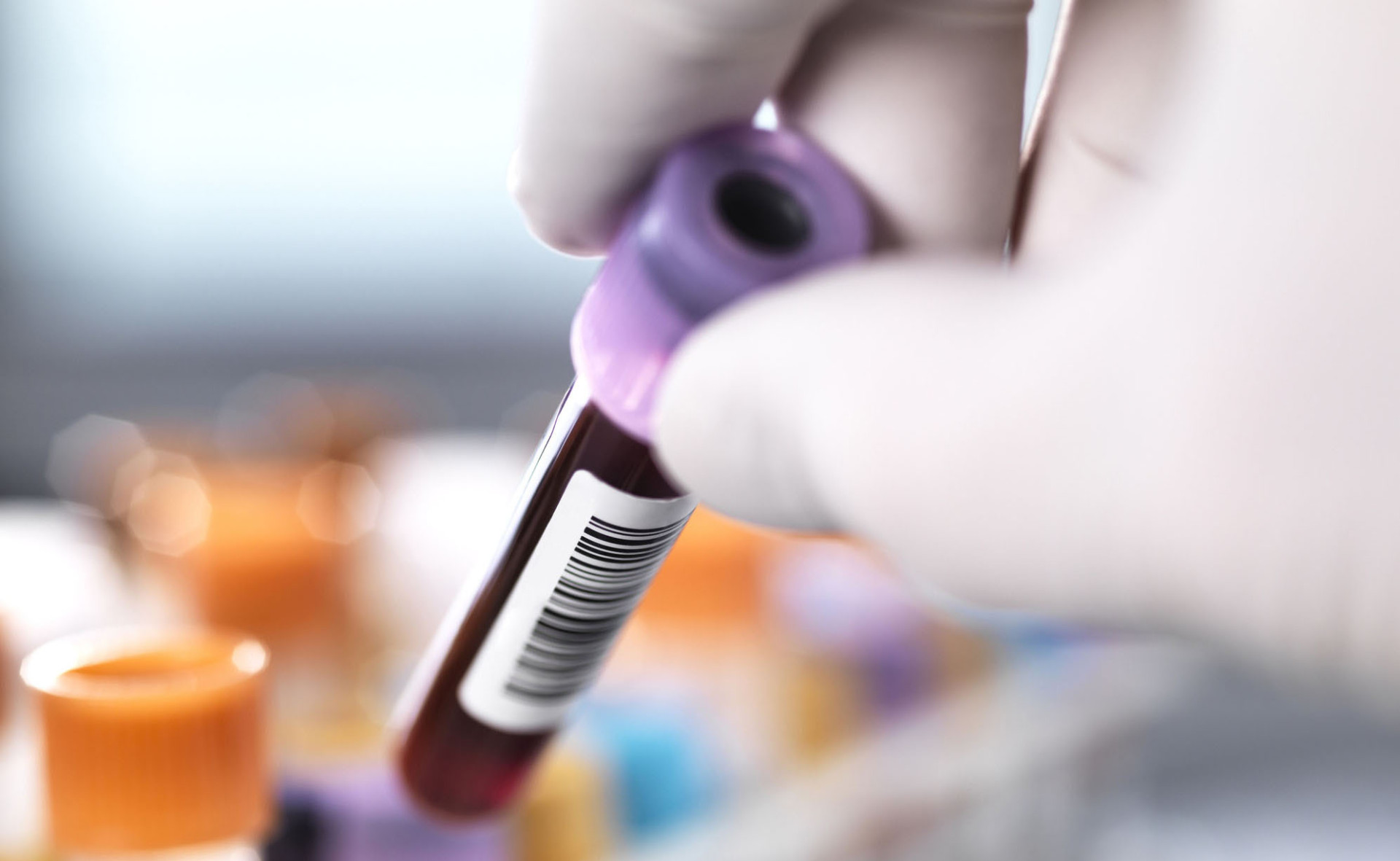 HealthCentral: Can a Blood Test Diagnose Hypertrophic Cardiomyopathy?