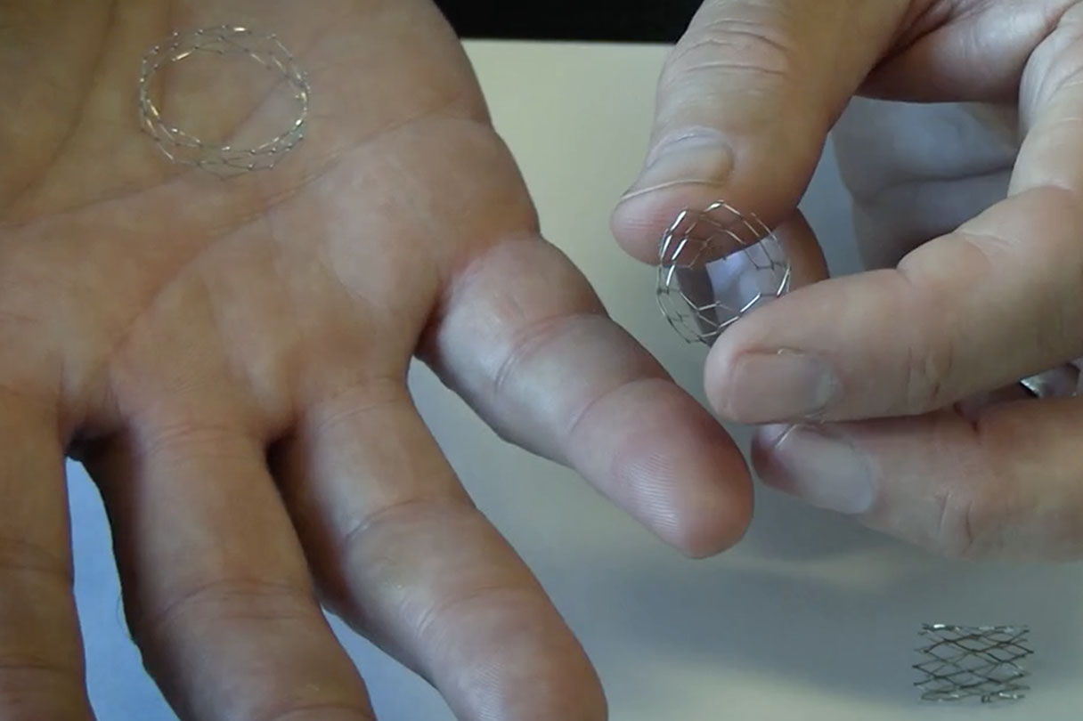 NBCNews.com: New Stents for Infants Mean Kids Could Avoid Series of ...