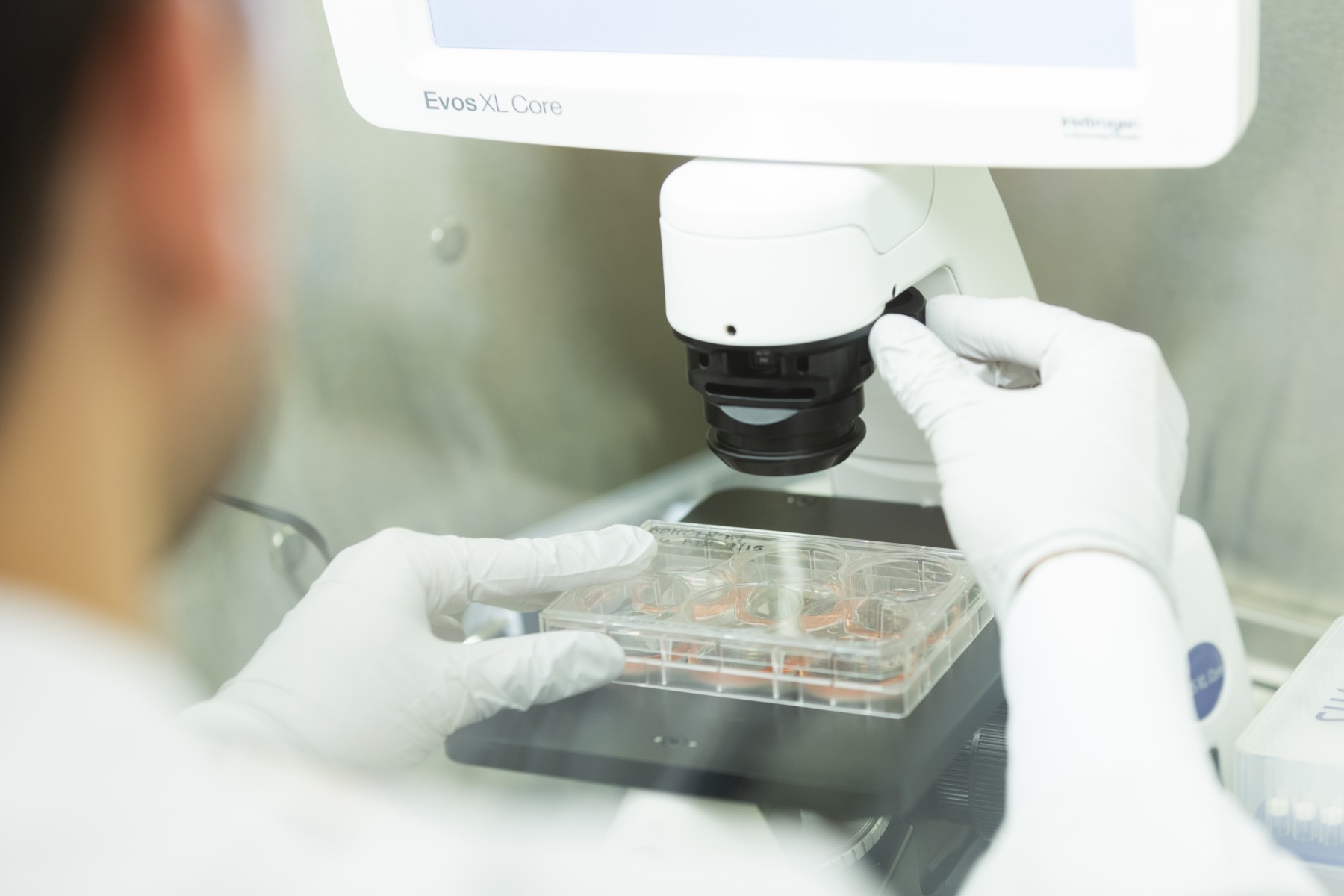 Noteworthy Medical Research Discoveries From 2022