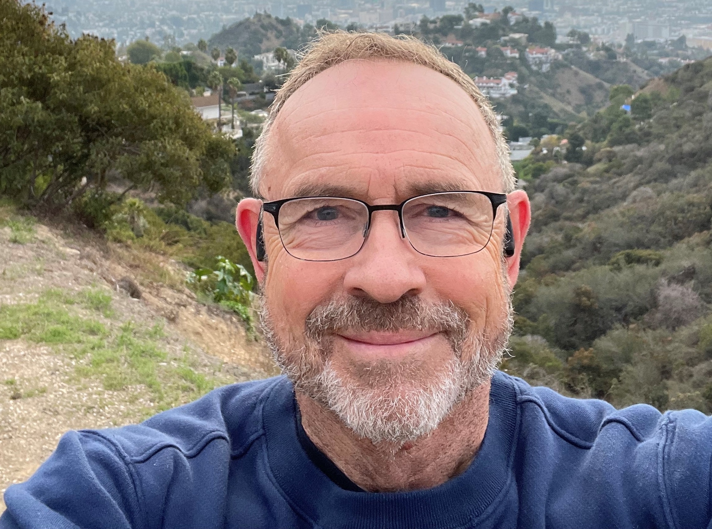 Climbing to New Heights After Robotic Coronary Artery Bypass Graft