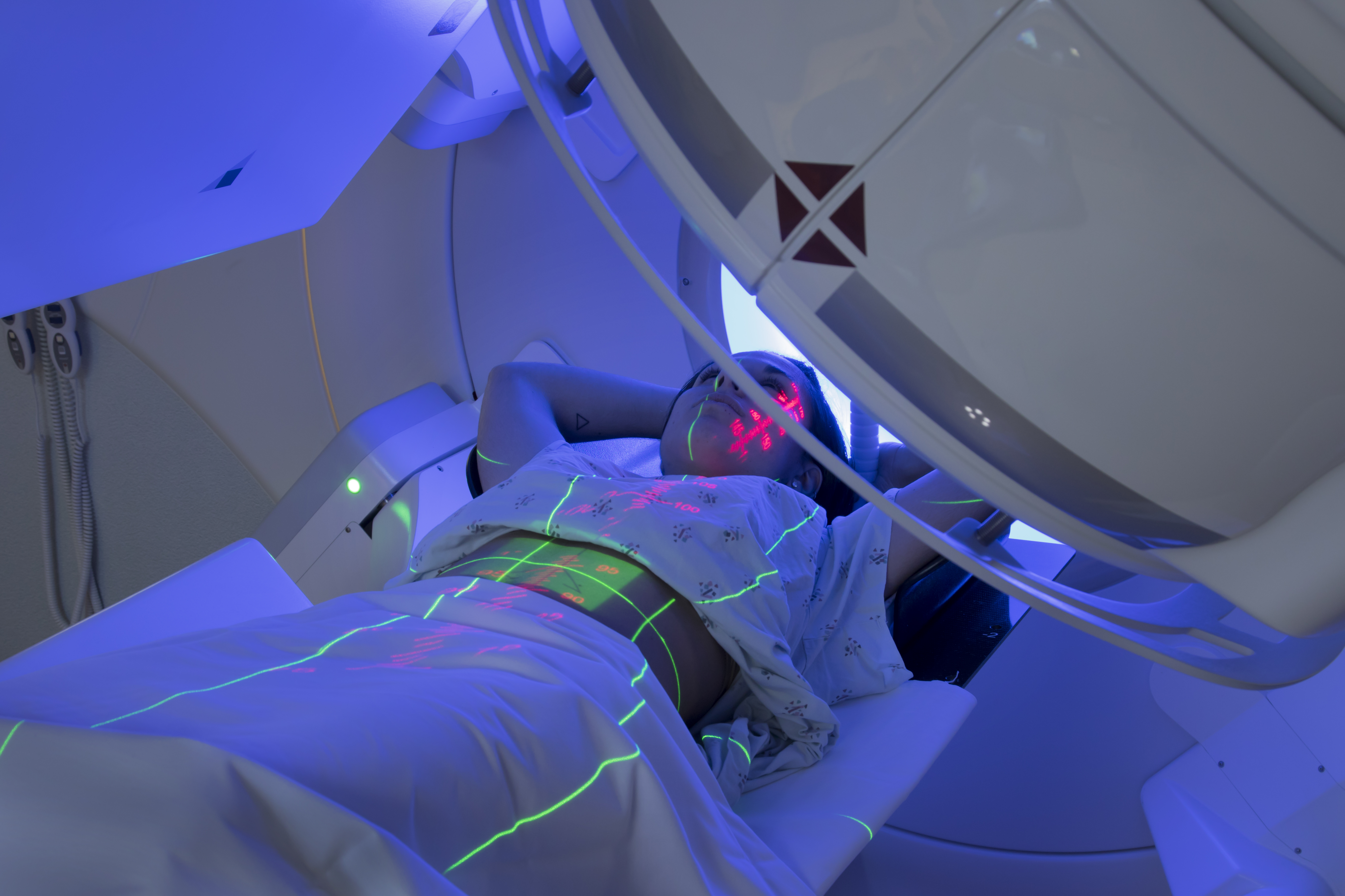 Making Radiation Therapy Safer for the Heart
