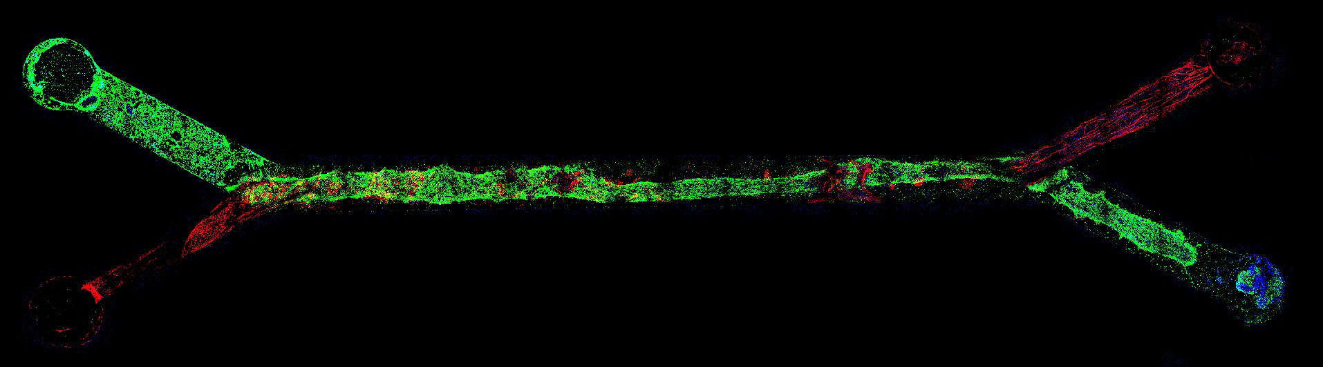 ‘Heart-on-a-Chip’ For Safer Cancer Treatment