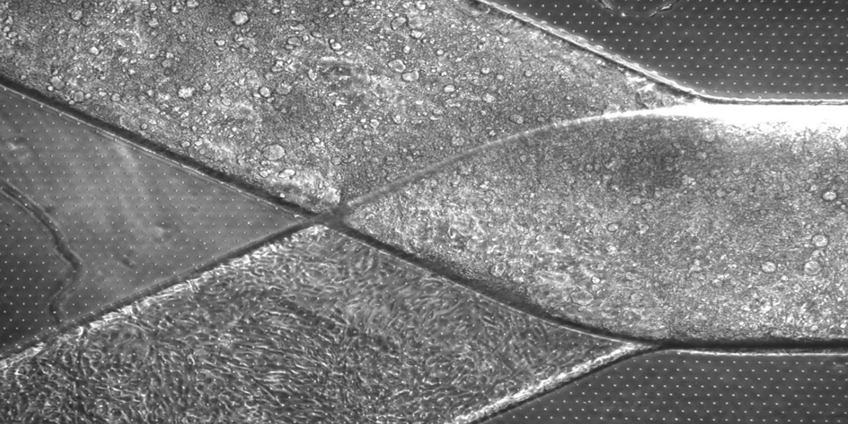 ‘Heart-on-a-Chip’ For Safer Cancer Treatment