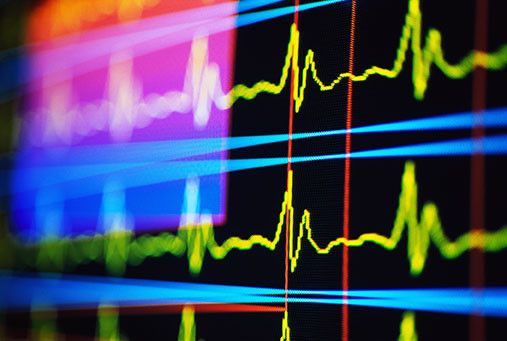 HealthCentral: Atrial Flutter vs. Atrial Fibrillation | What’s the ...
