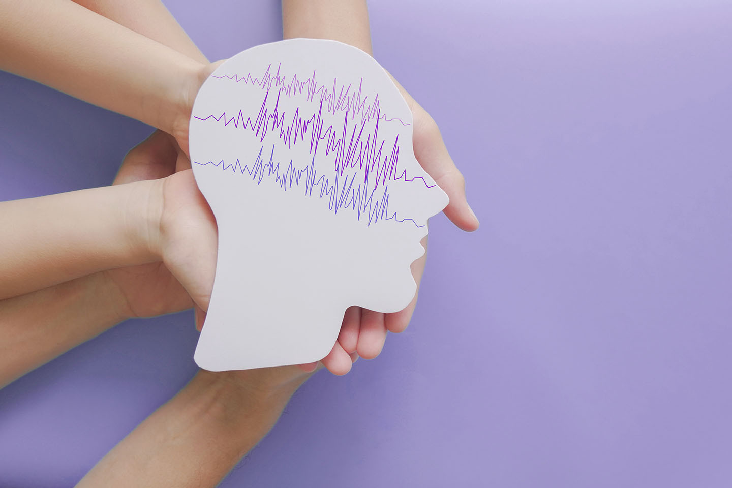 ¿Qué es el Síndrome de Dravet?