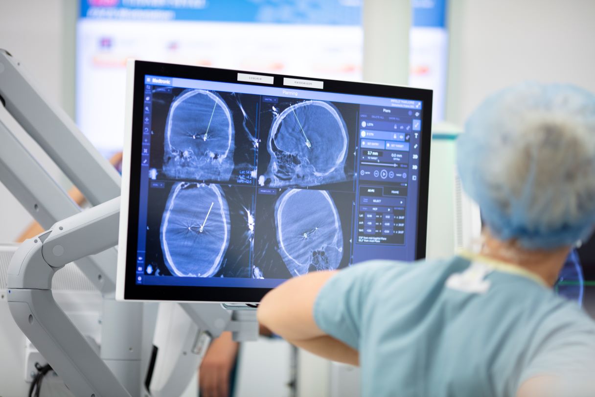 Can Deep Brain Stimulation Help More Patients?