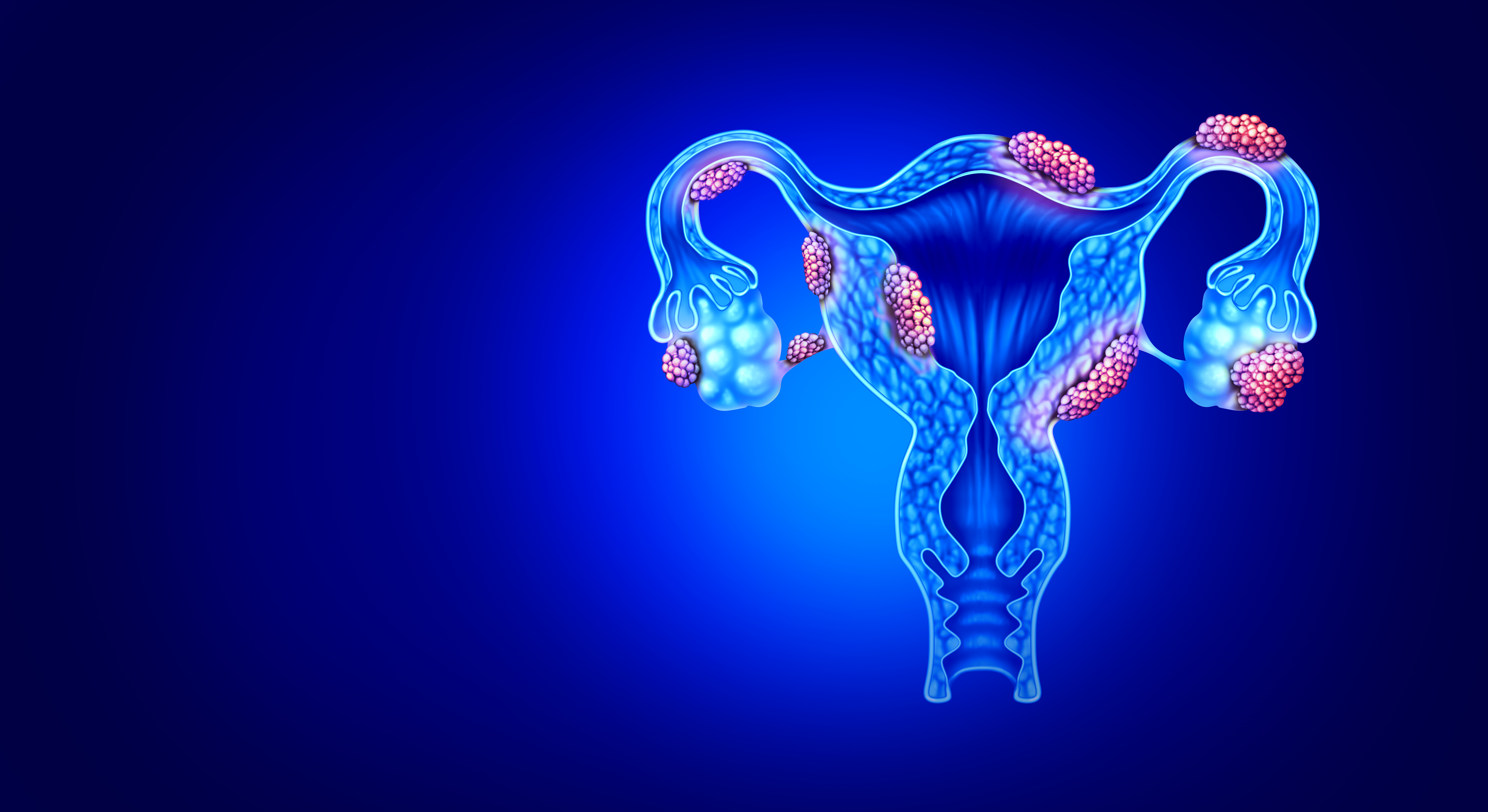 Cedars-Sinai Experts Share Gynecologic Surgery Advances