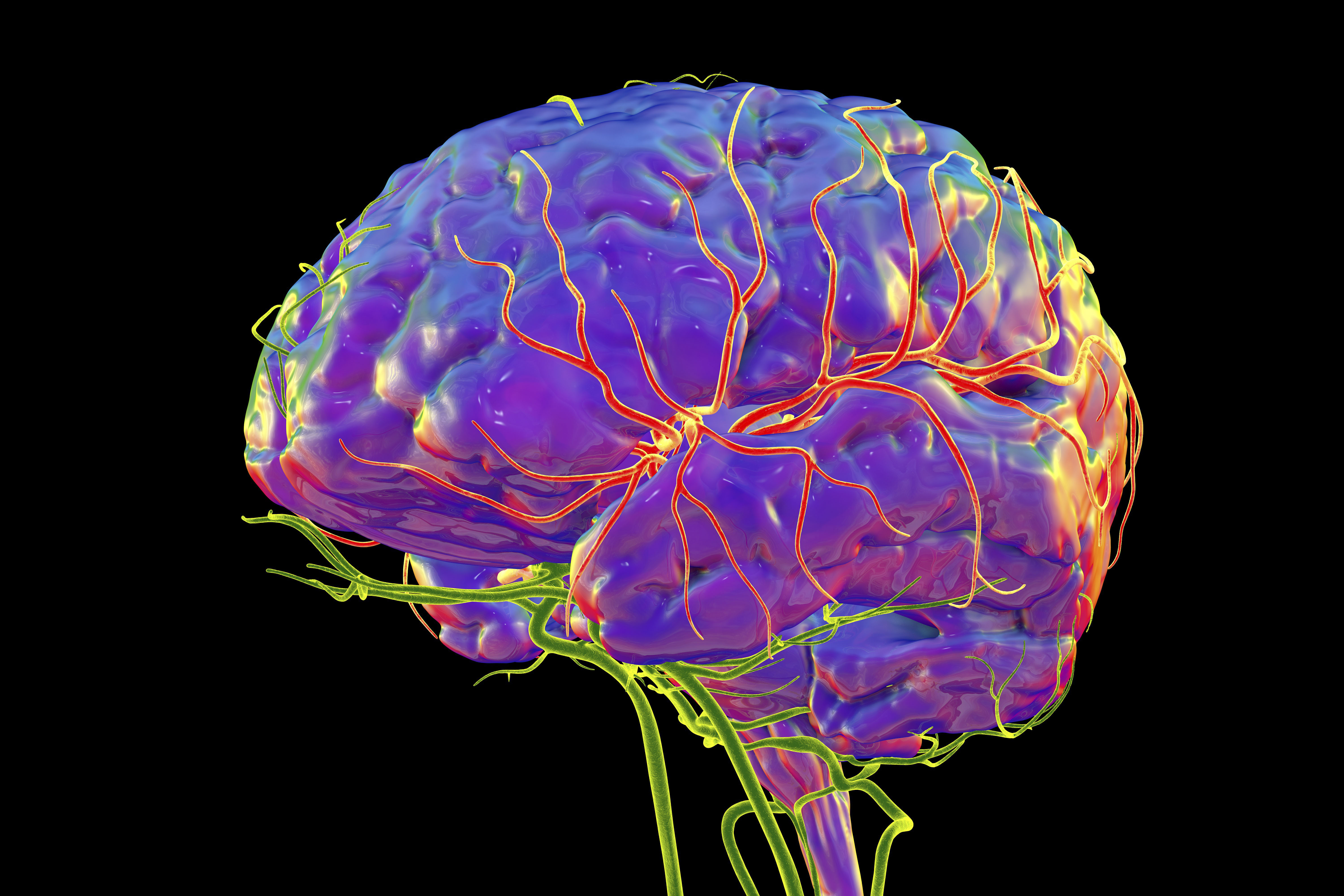 Cedars-Sinai Expert Explains New Stroke Treatment Guideline