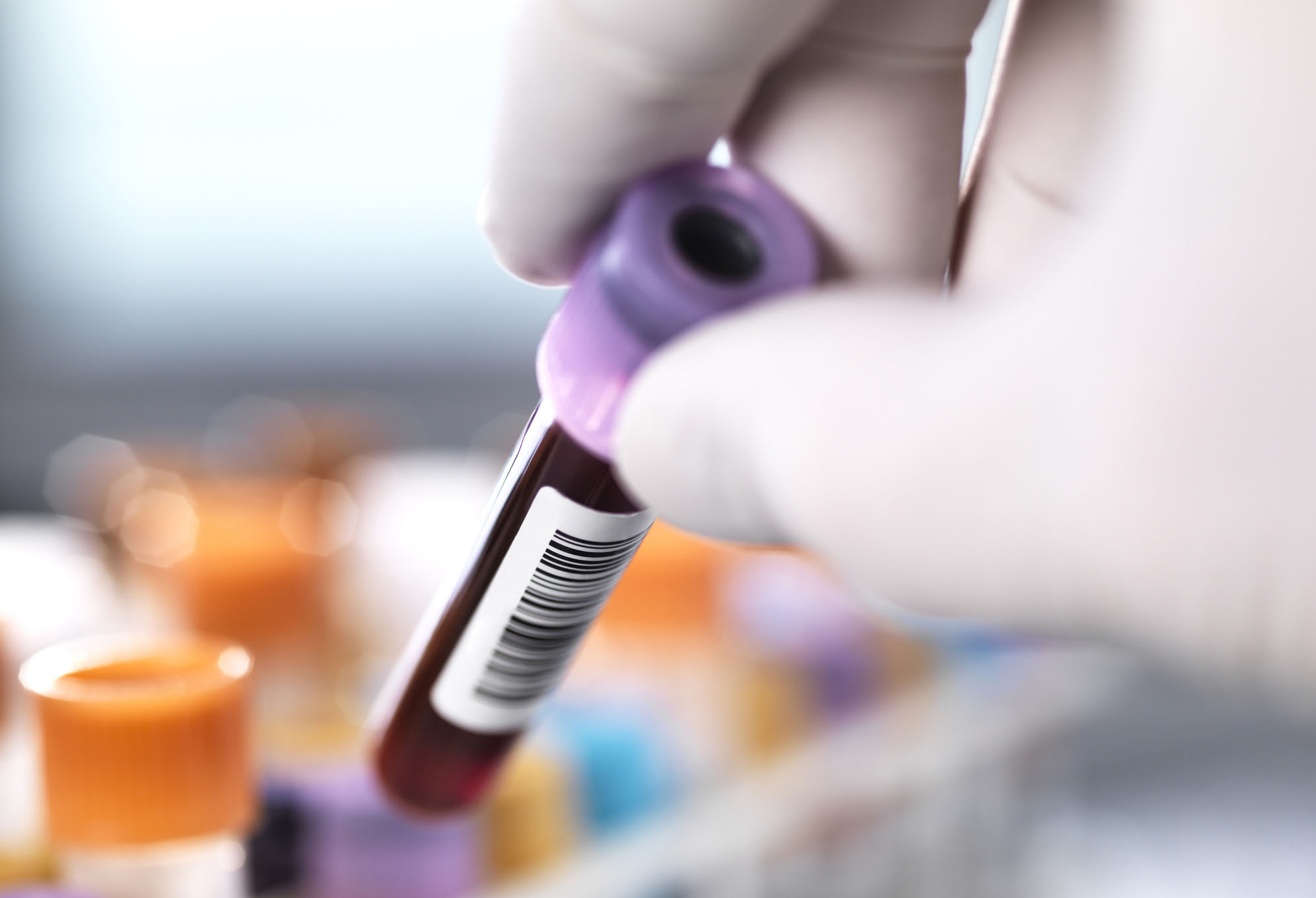 Can Blood Tests Detect Cancer? | Cedars-Sinai