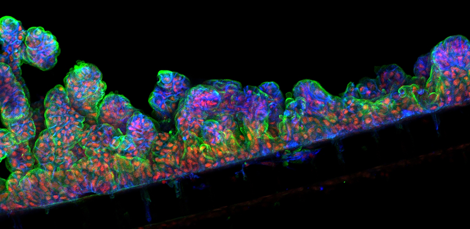 Scientists Produce Human Intestinal Lining That Re-Creates Living ...