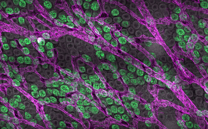 Study Provides Insight Into How the Intestine Repairs Damaged Tissue