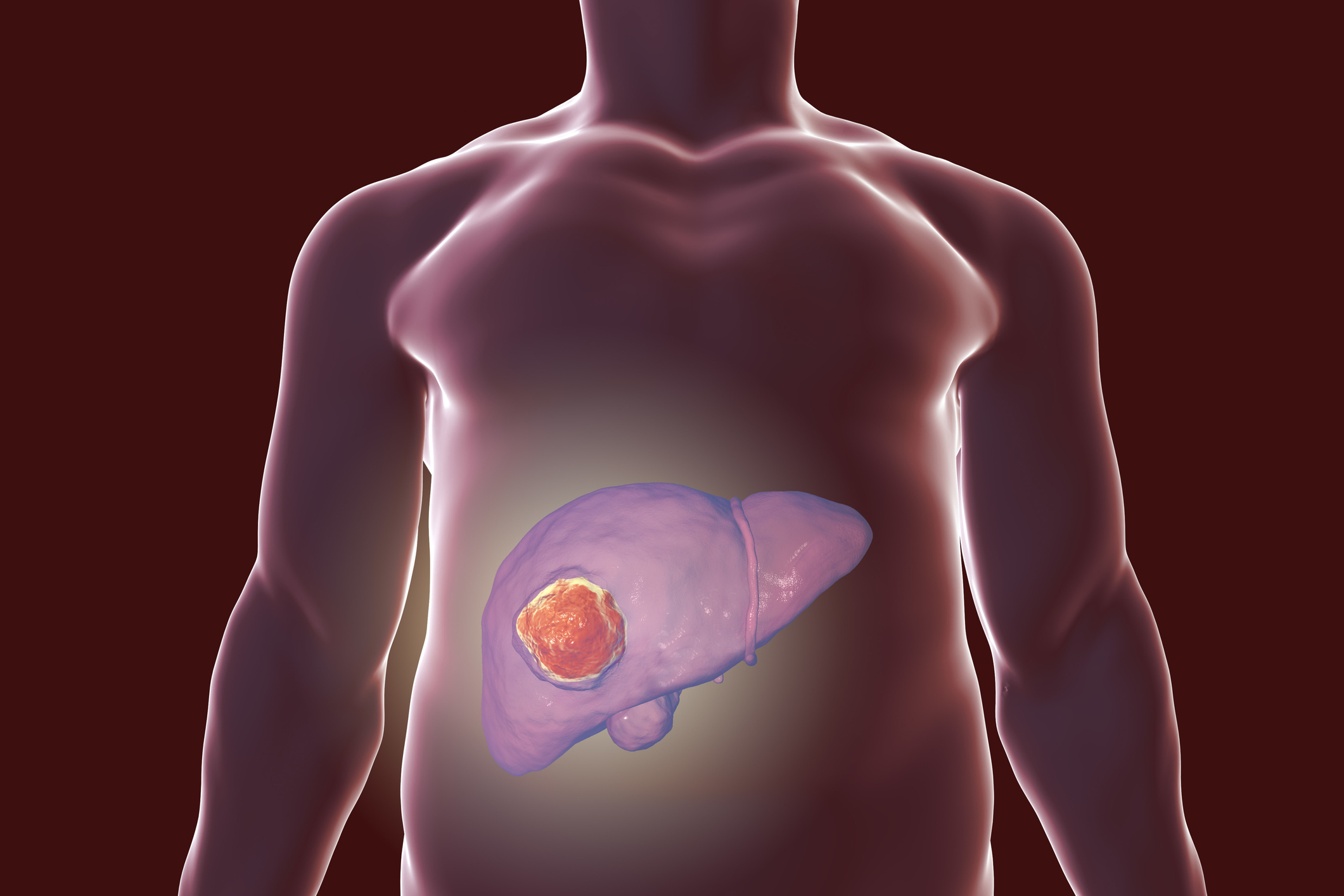 Study Uncovers New Treatment Approaches for Liver Cancer
