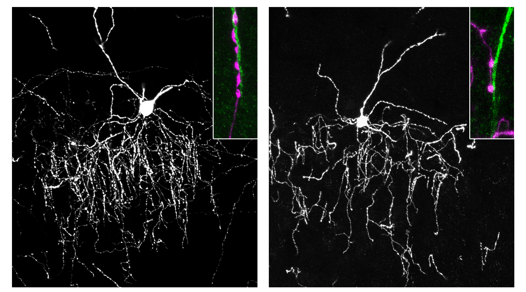 One way brain ‘conductors’ find precise connection to target cells