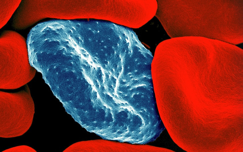 Paper-based devices diagnose malaria in asymptomatic people