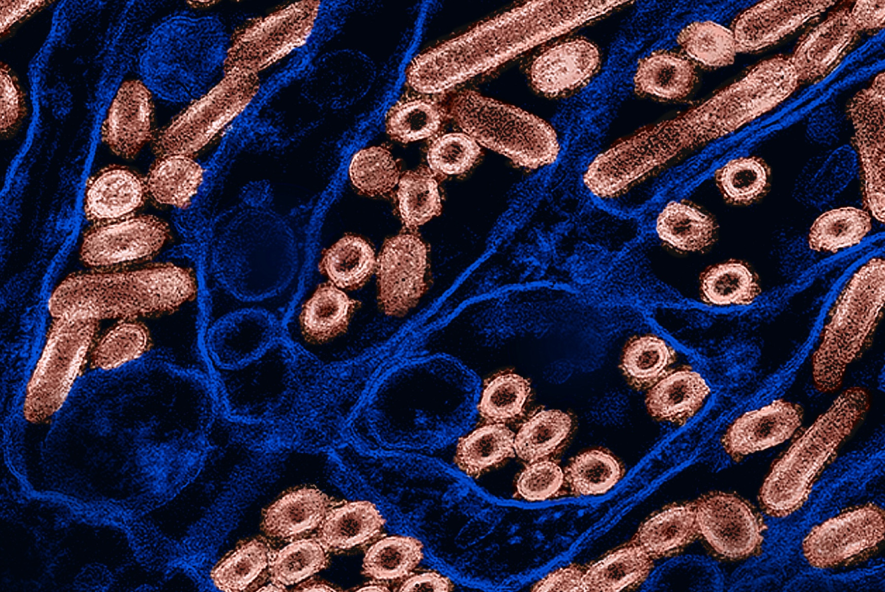 New roles in infectious process for molecule that inhibits flu