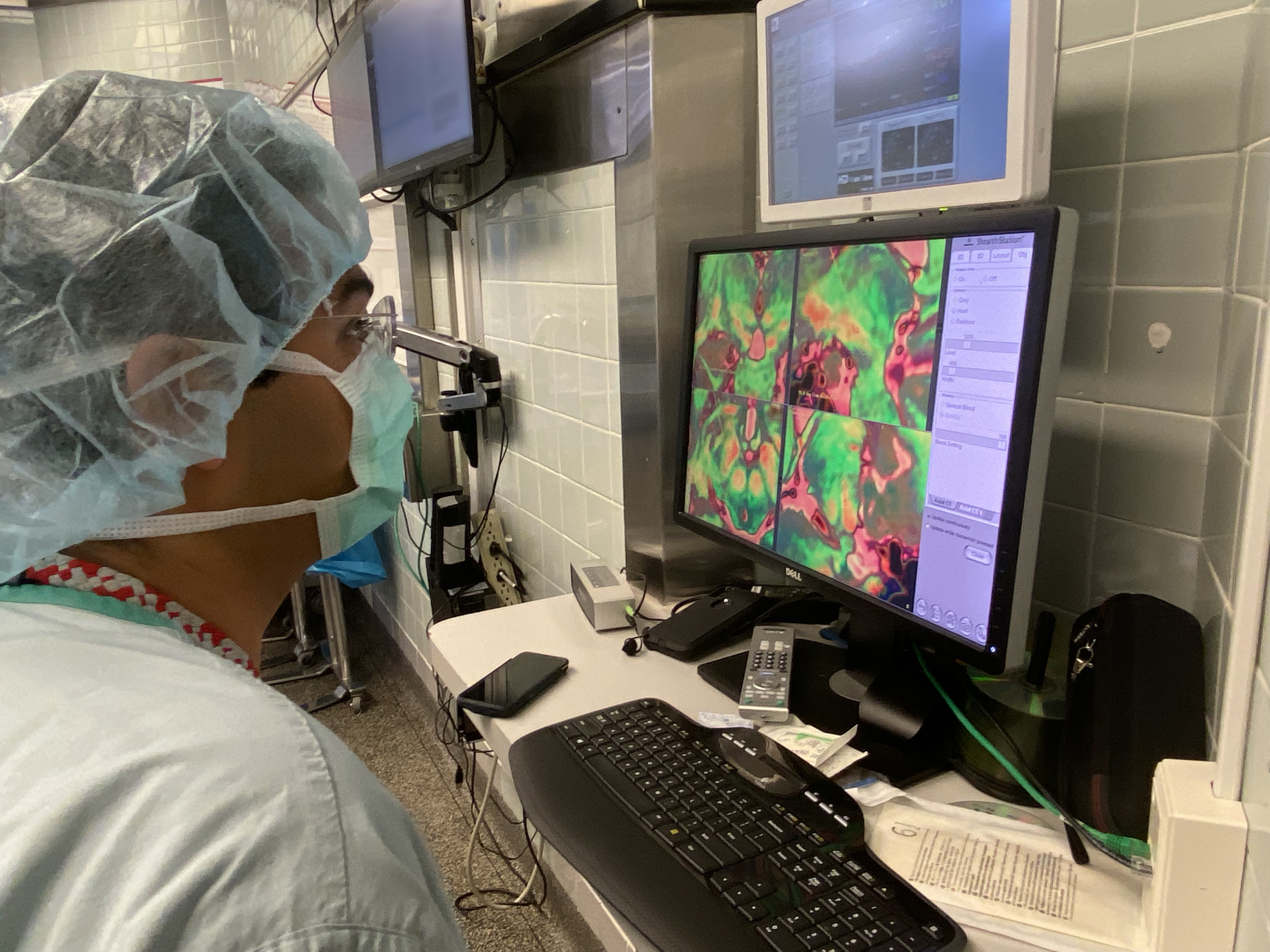 Ohio State among first in nation to implant new deep-brain stimulation ...