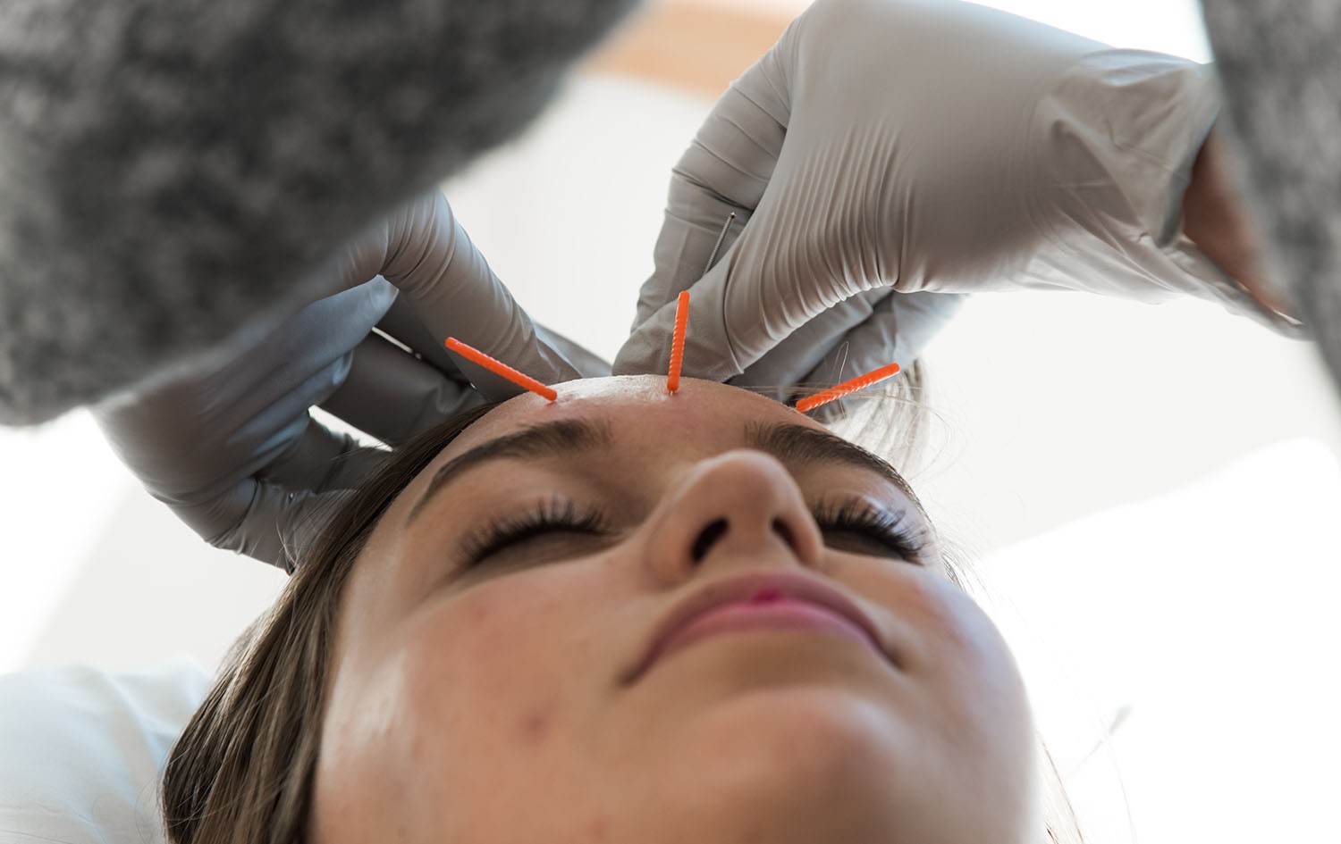 Pediatric Headaches: A Patient-Centered Approach to Tiered Levels of Care