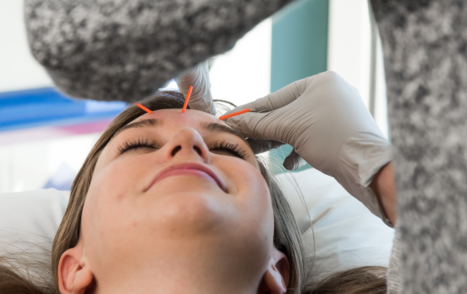 Neurology Headache Team Creates Basic Acupuncture Curriculum