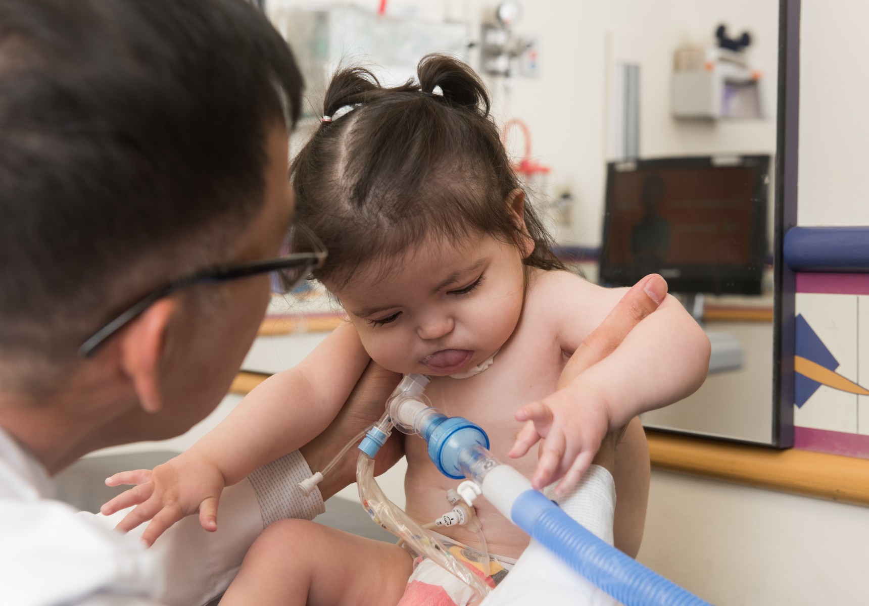 How Tracheostomy Affects Development in Infants With Severe BPD