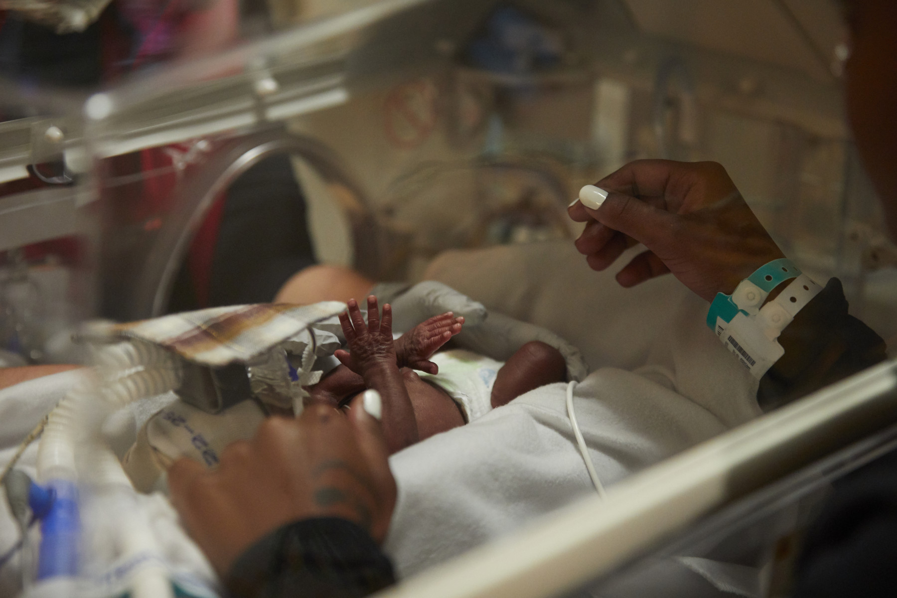 CORD-CHD: Cord Clamping Among Neonates with Congenital Heart Disease