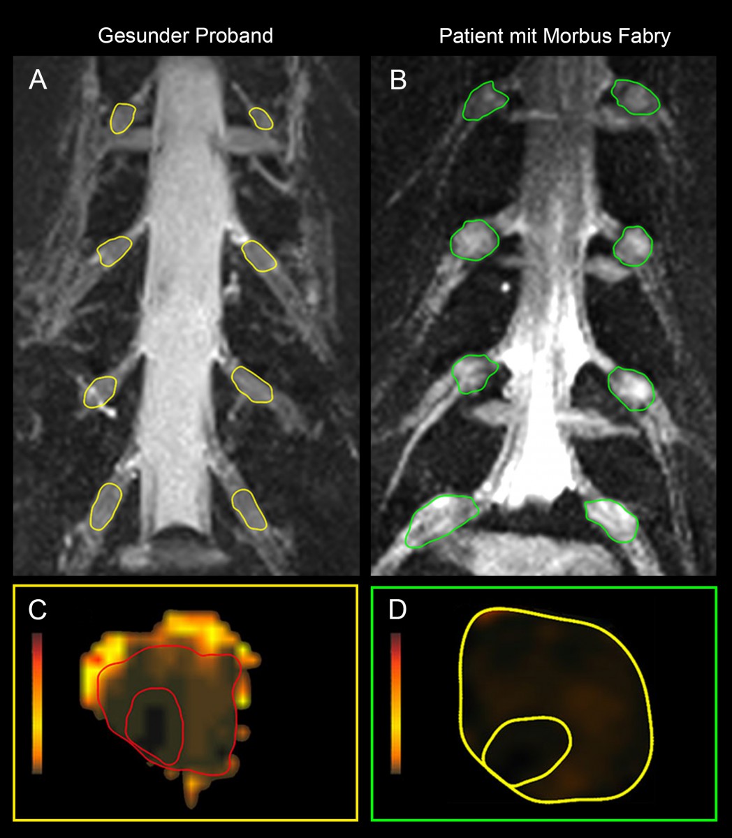 Nervenschmerzen sichtbar machen und behandeln