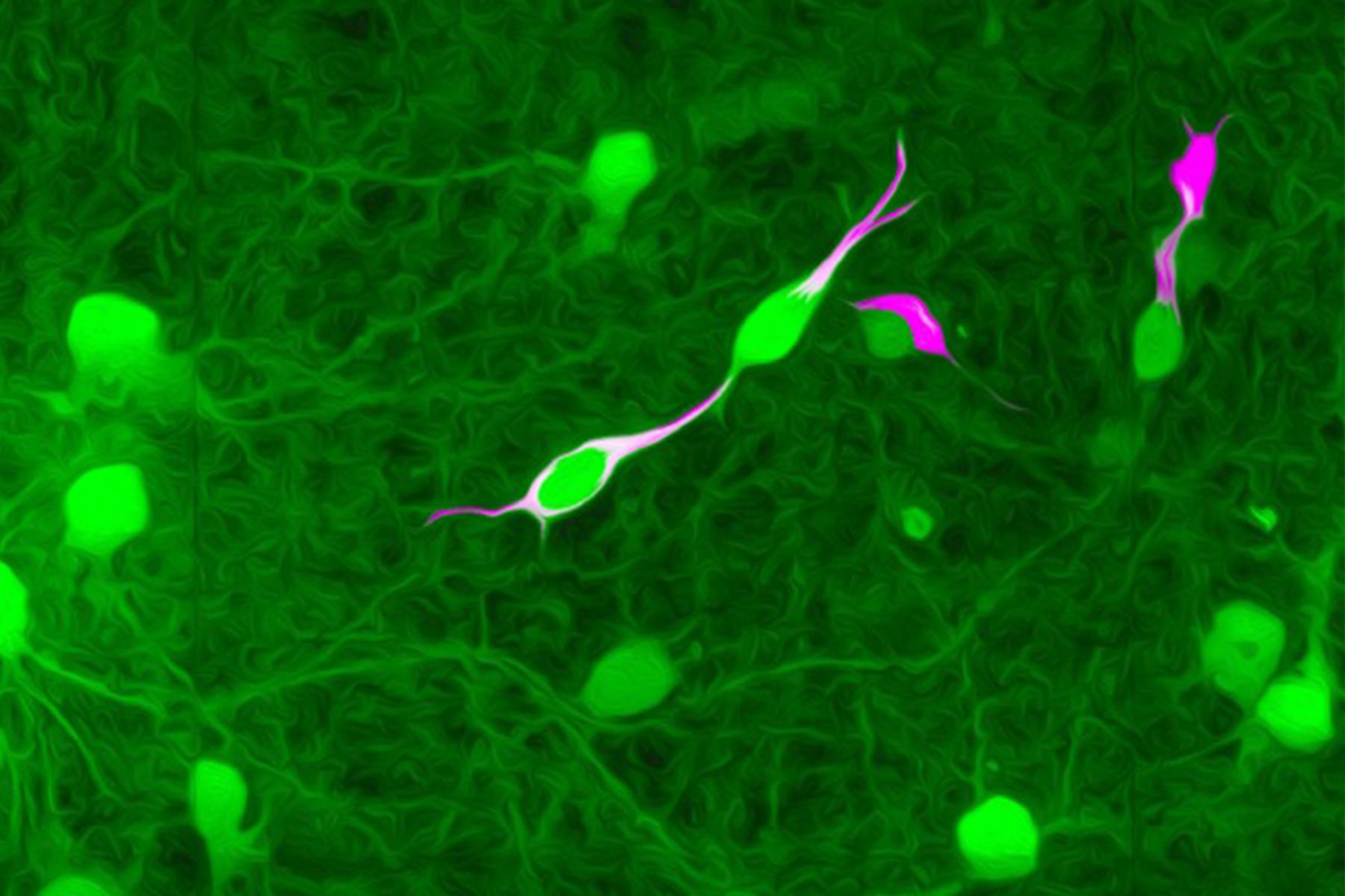 Wie werden Krebszellen resistent? Wilhelm Sander-Stiftung fördert zwei ...